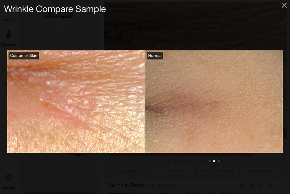 Ionto-Scope API 100 - MSK Podiamed